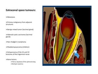 Imaging in orbital pathology | PPTX
