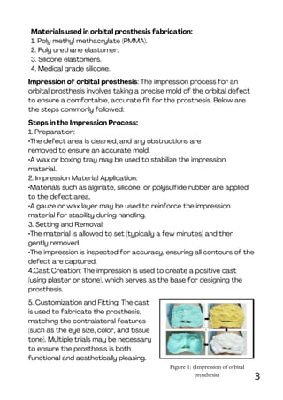Orbital prosthesis (Anatomy,impression and cast preparation) 2.pdf