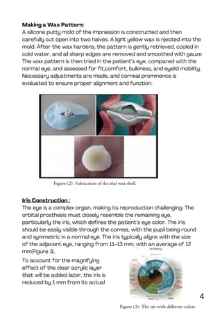 Orbital prosthesis (Anatomy,impression and cast preparation) 2.pdf