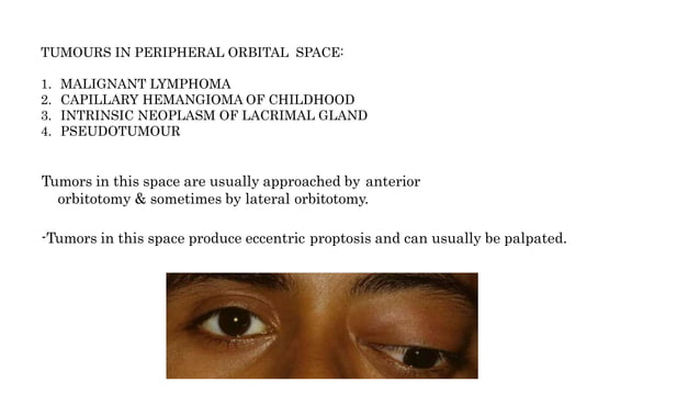Orbital spaces | PPTX | Eye and Vision Conditions | Diseases and Conditions