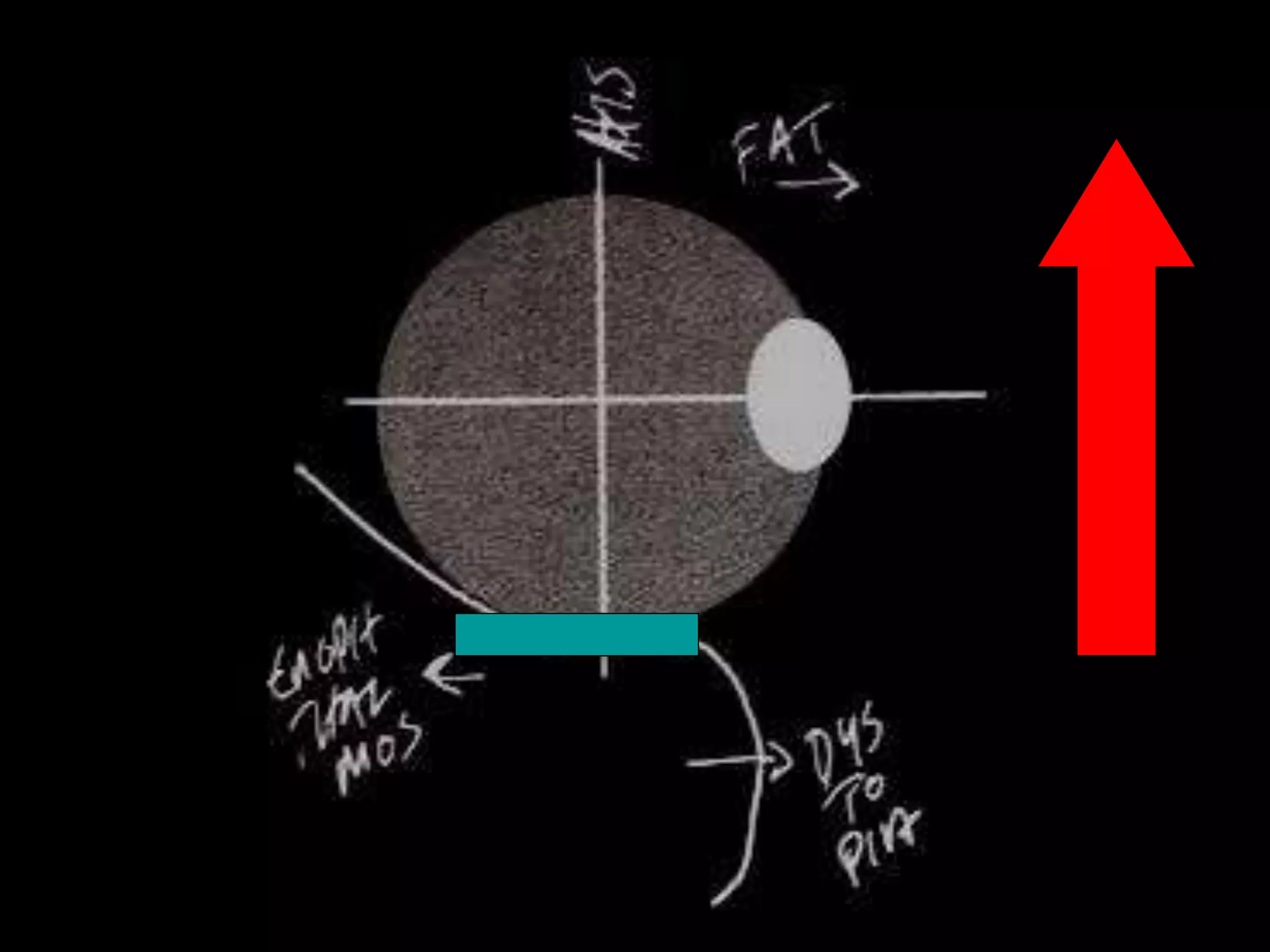 Orbital surgery anatomy pearls | PPTX