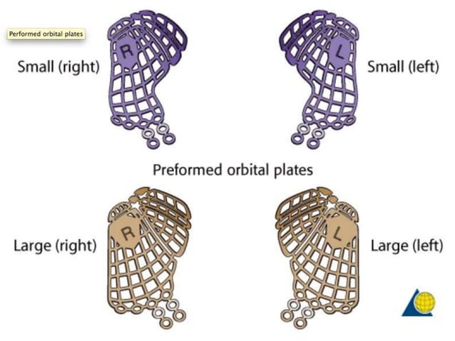 Orbital surgery anatomy pearls | PPT
