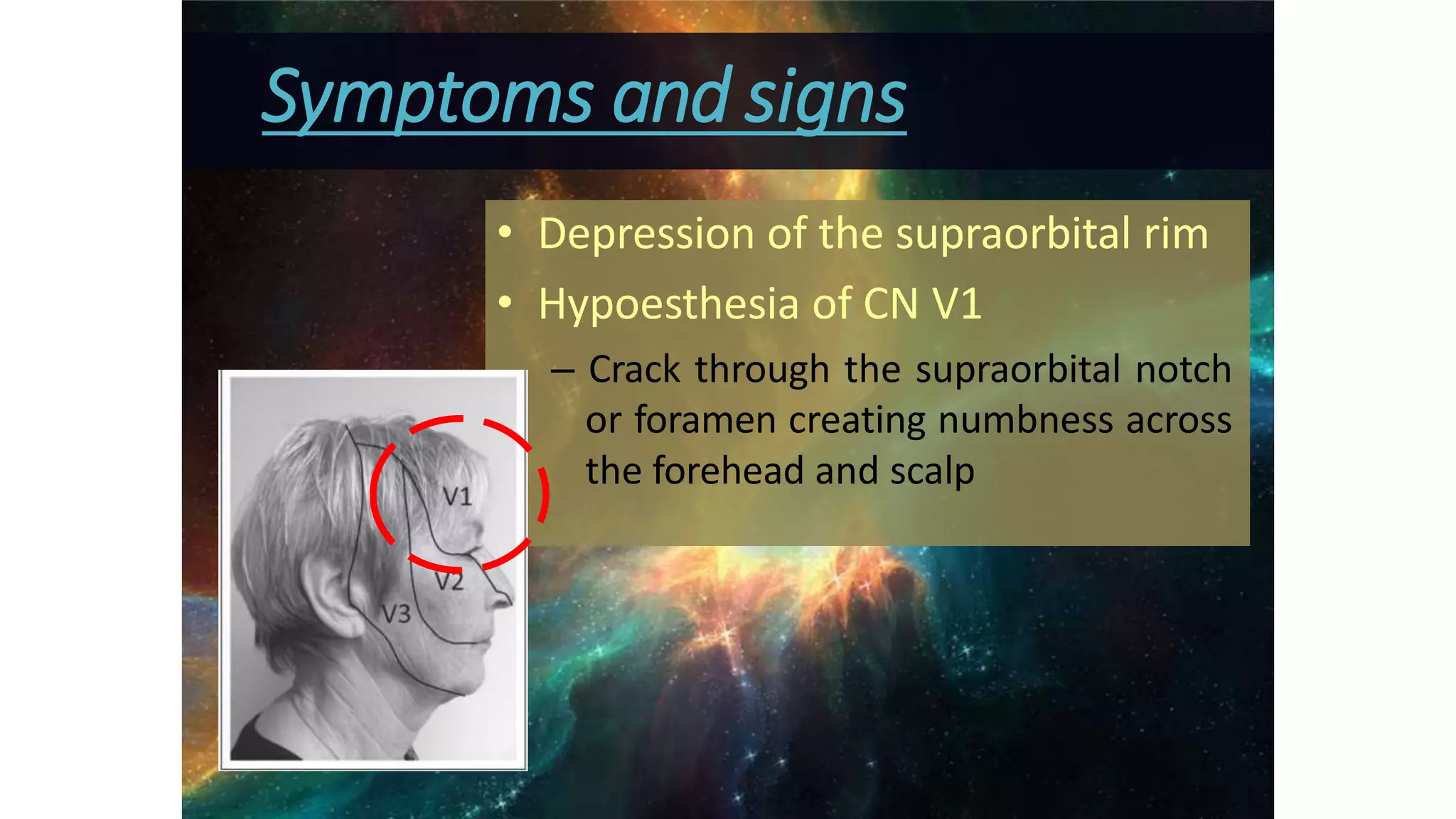 Orbital trauma | PPTX