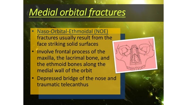 Orbital trauma | PPTX