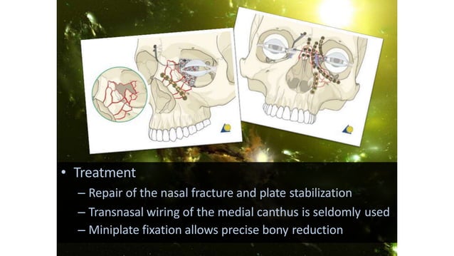 Orbital trauma | PPTX