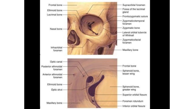 Orbital trauma | PPTX