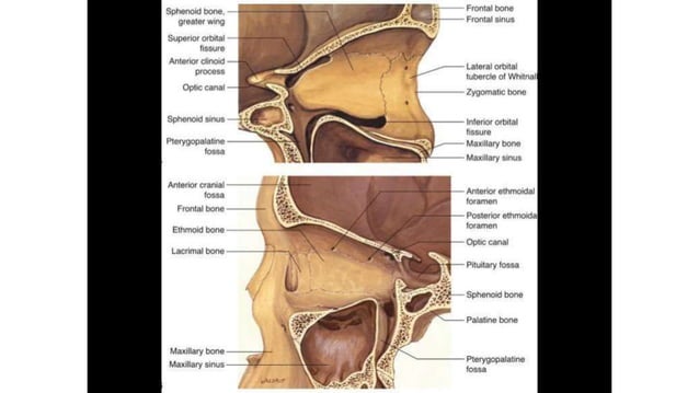 Orbital trauma | PPTX