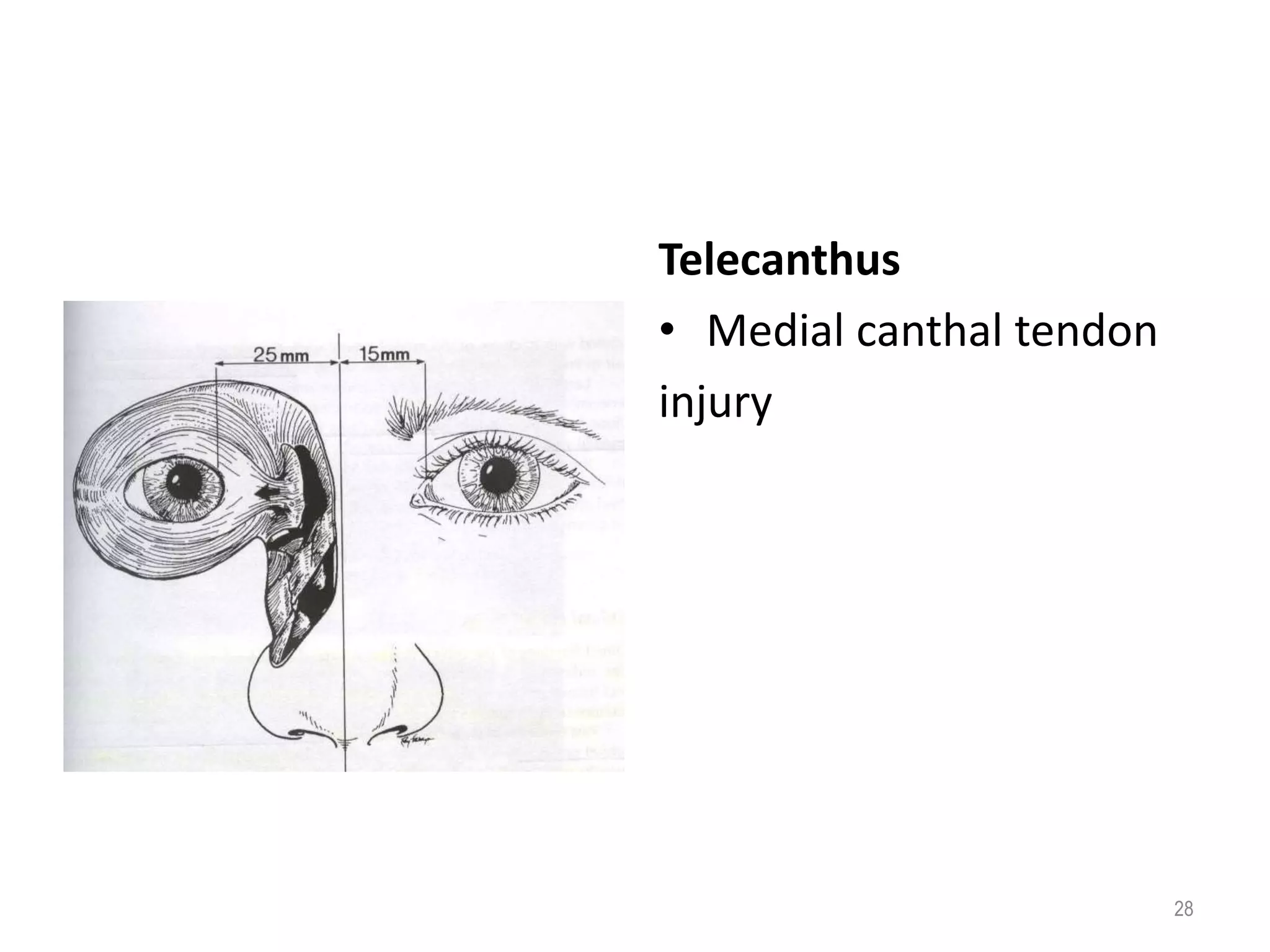 Orbital trauma 1 | PPT