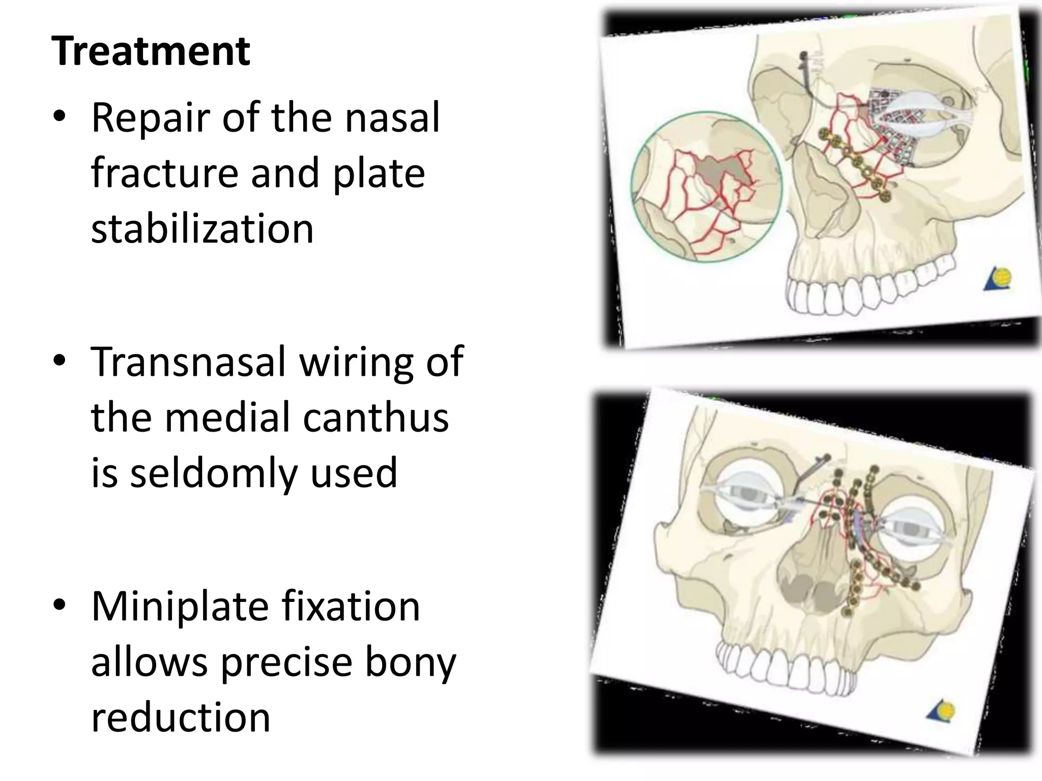 Orbital trauma 1 | PPT