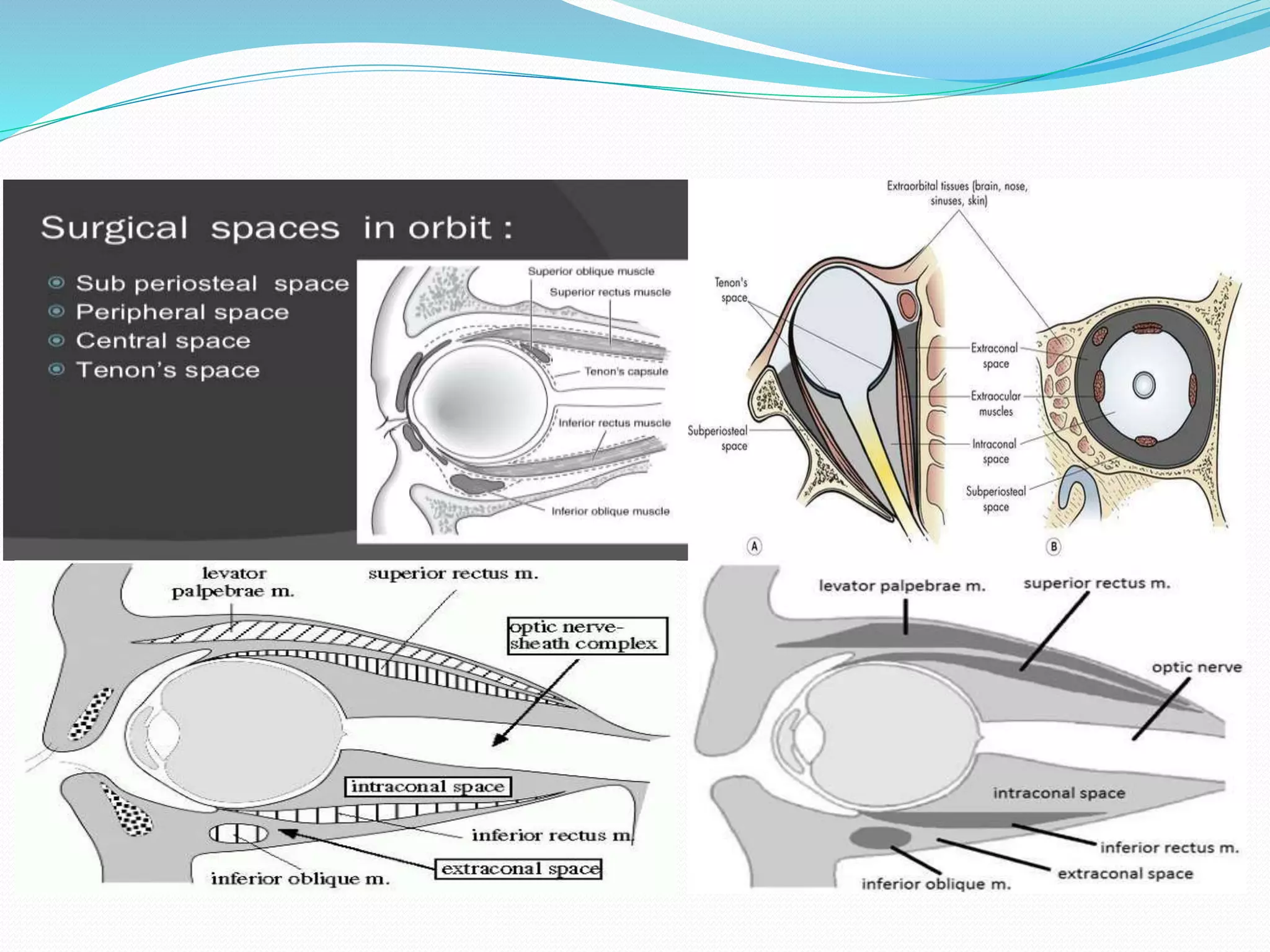 Orbital Tumor Case Presentation Dr Mumtaz Ali Pptx Eye And Vision Conditions Diseases And