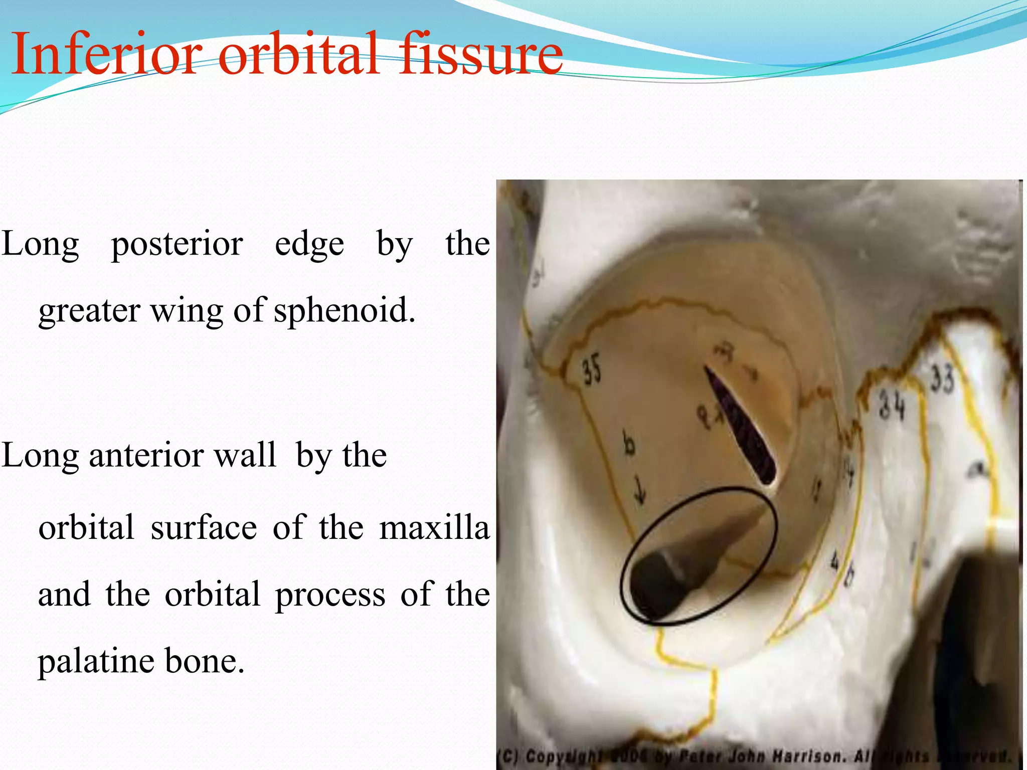 Orbital tumor and surgical approaches | PPTX