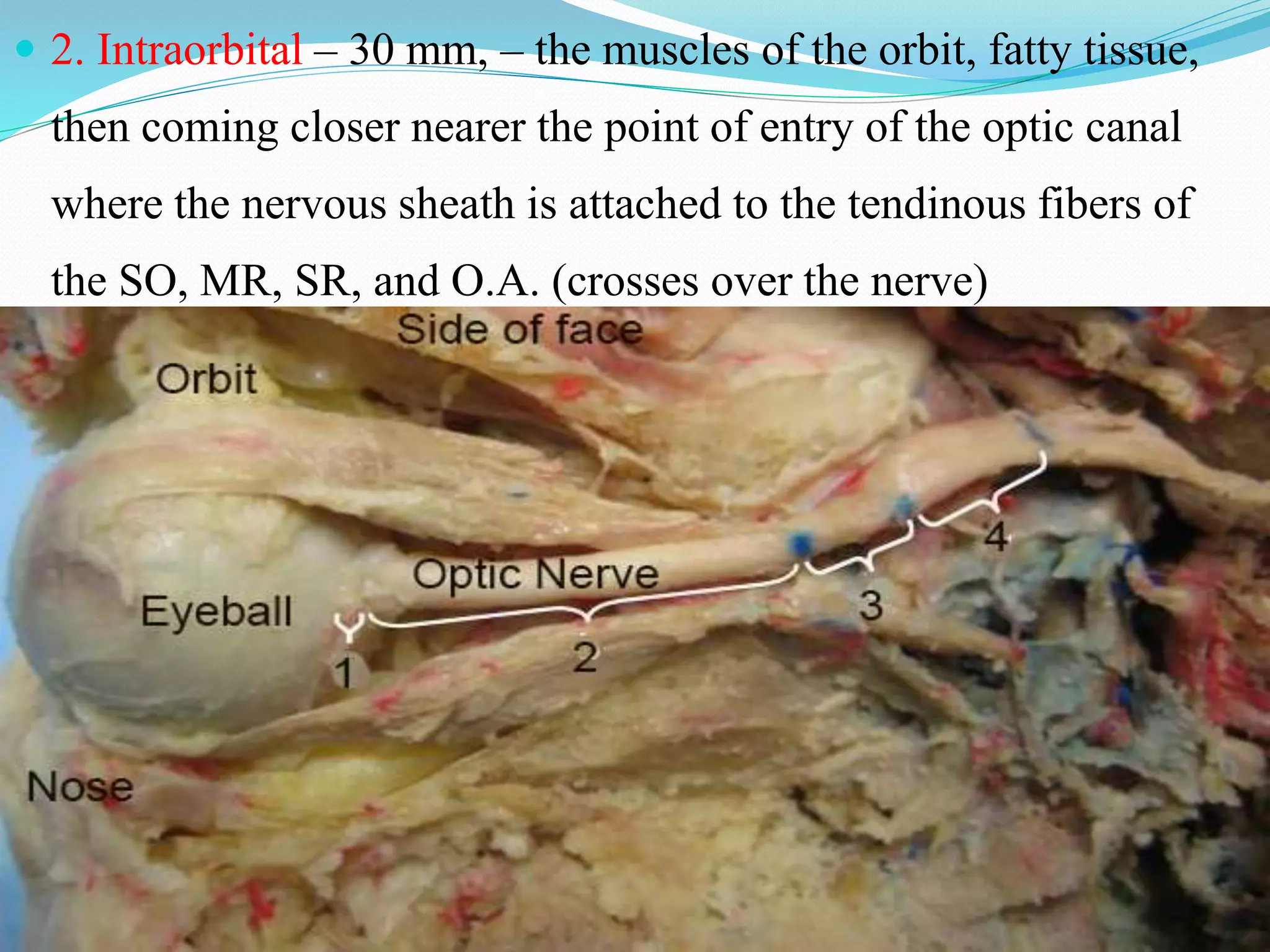 Orbital tumor and surgical approaches | PPTX