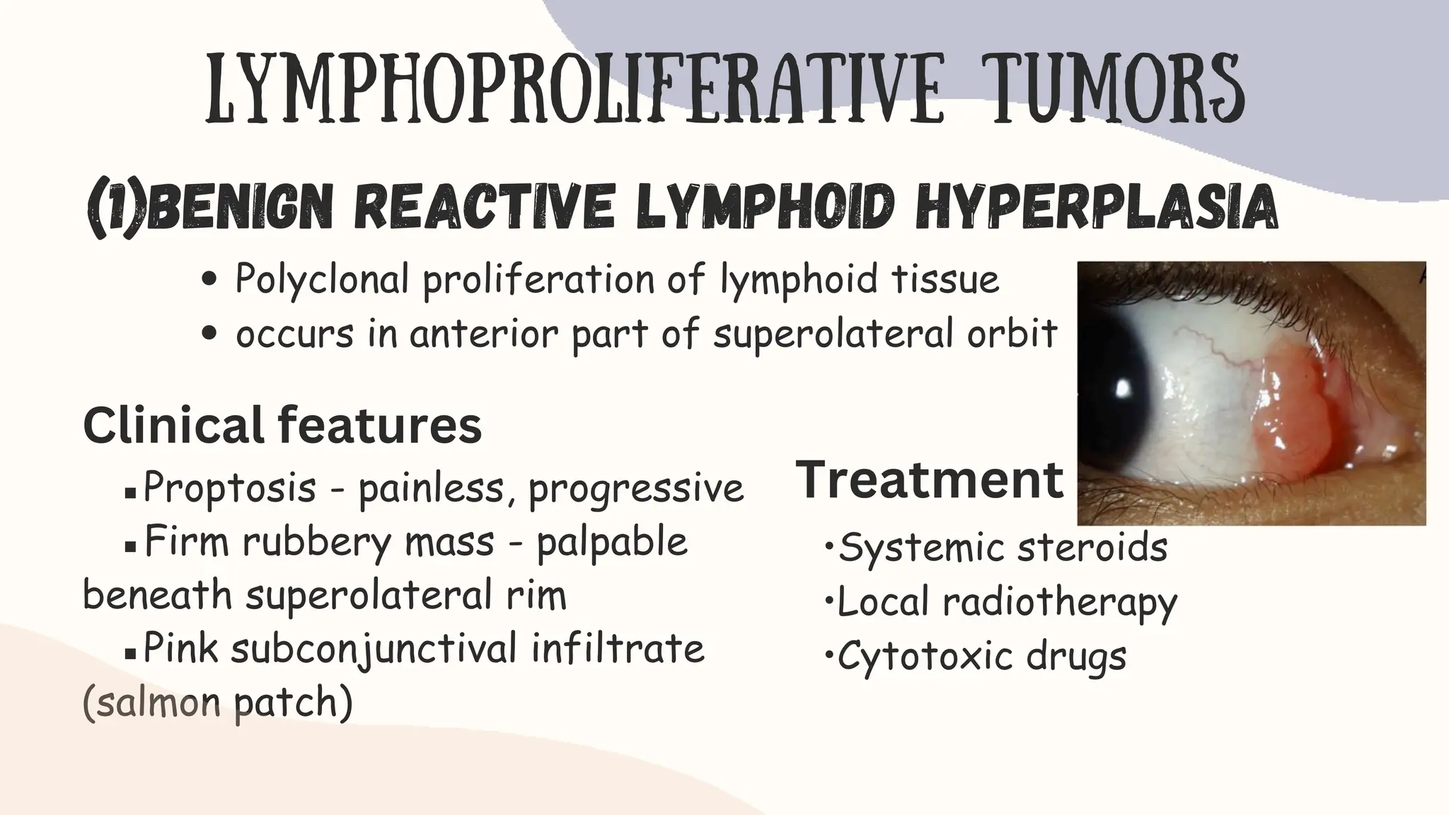 Orbital tumors in Opthalmology.......... | PDF