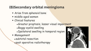 Orbital tumors in Opthalmology.......... | PDF