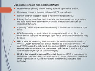 imaging of Orbital tumours | PPTX