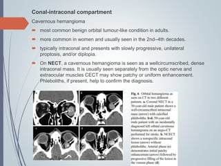 imaging of Orbital tumours | PPTX