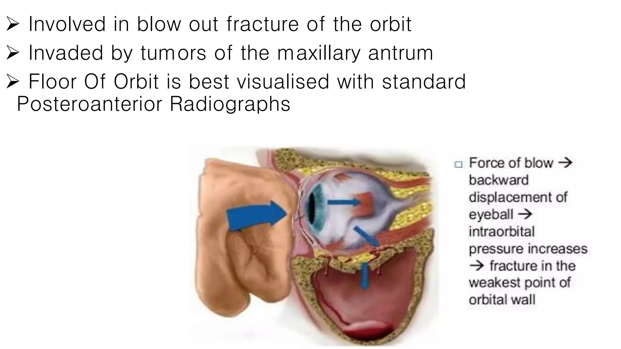 Orbit Anatomy and Surgical Spaces | PPTX