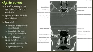 Radiological anatony of orbit | PPTX