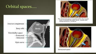 Radiological anatony of orbit | PPTX