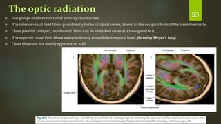 Radiological anatony of orbit | PPTX