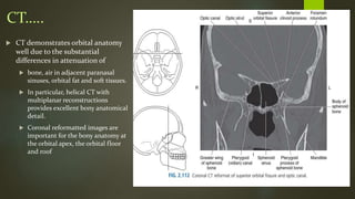 Radiological anatony of orbit | PPTX