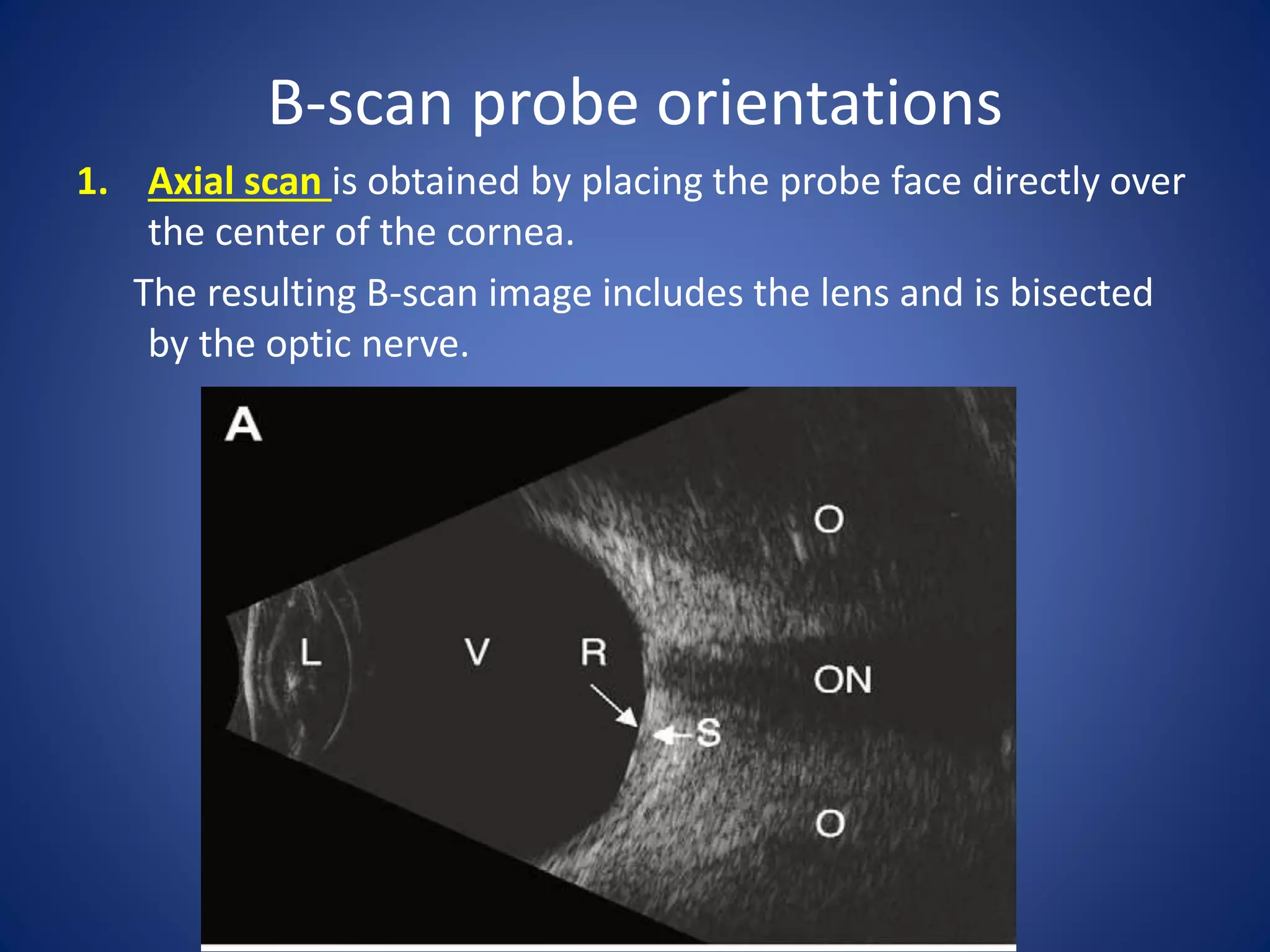 Orbit imaging anatomy | PPTX