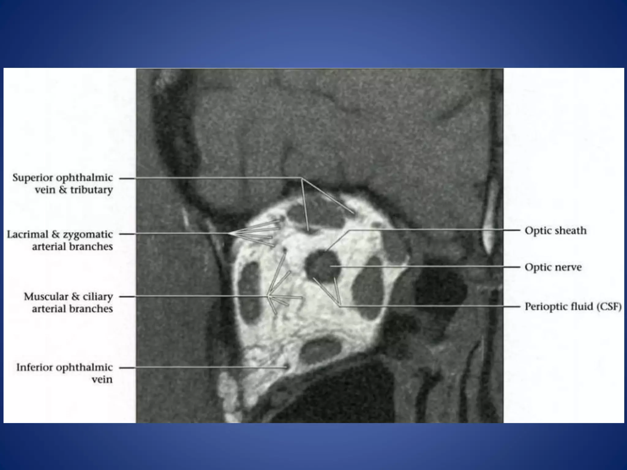 Orbit imaging anatomy | PPTX
