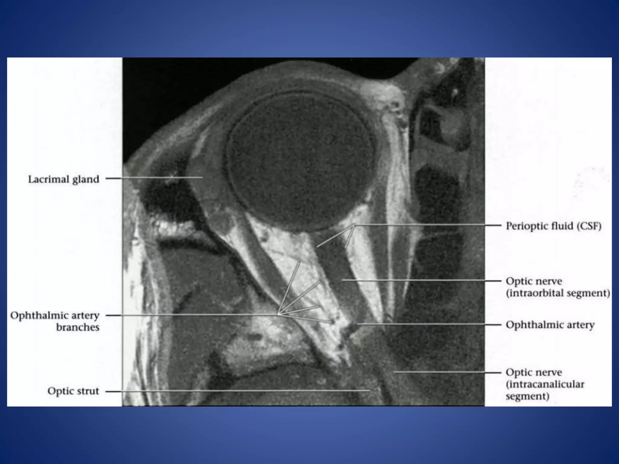 Orbit imaging anatomy | PPTX