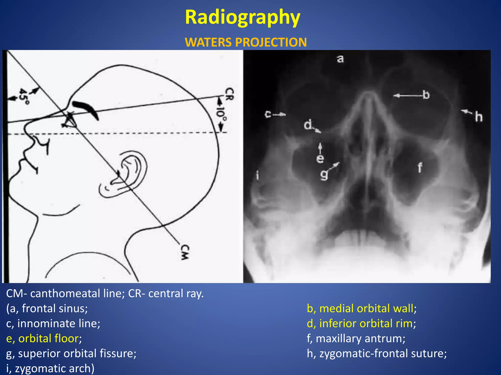 Orbit imaging anatomy | PPTX