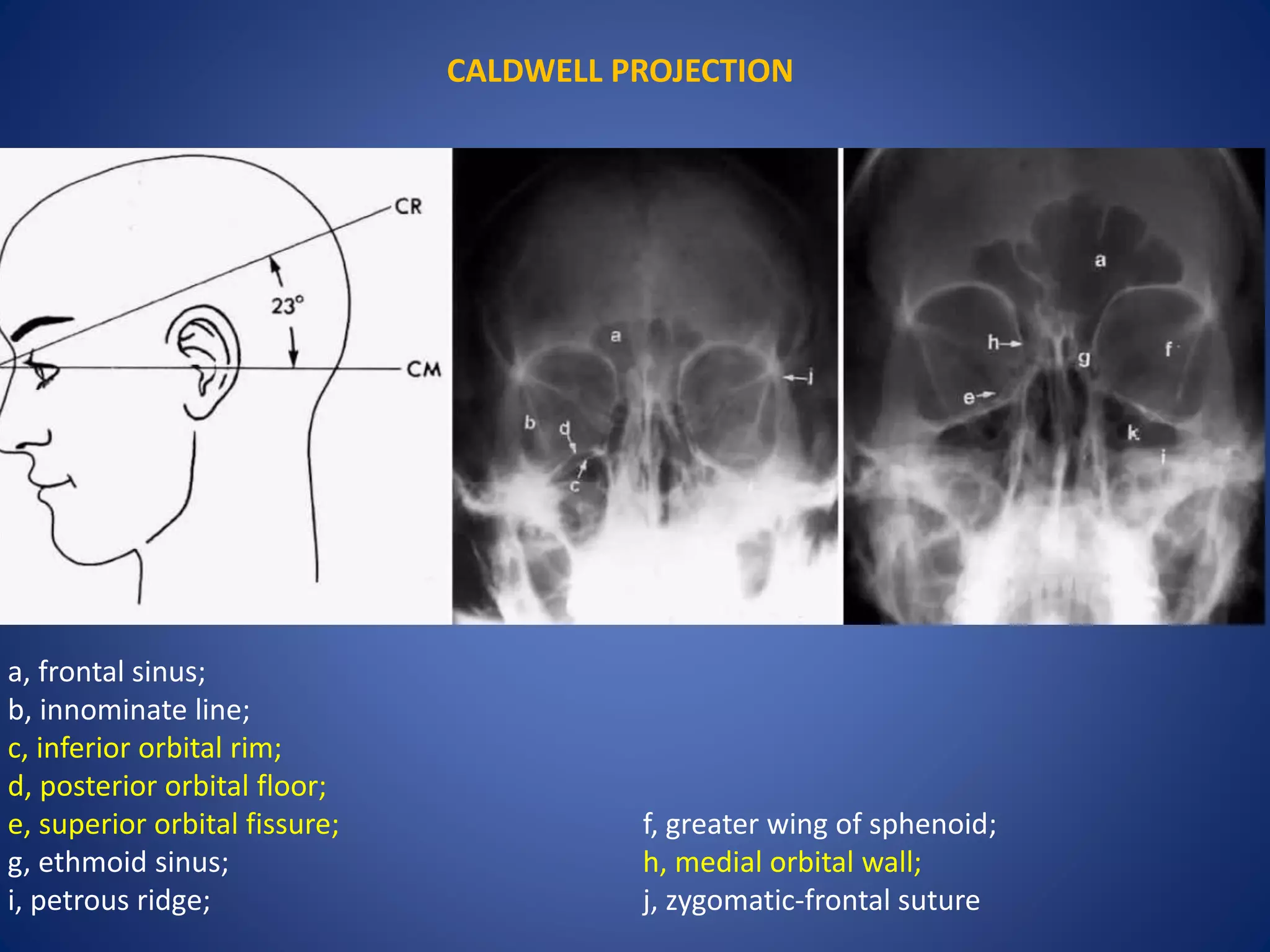Orbit imaging anatomy | PPTX