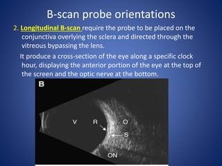 Orbit imaging anatomy | PPTX