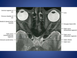 Orbital Septum Radiology
