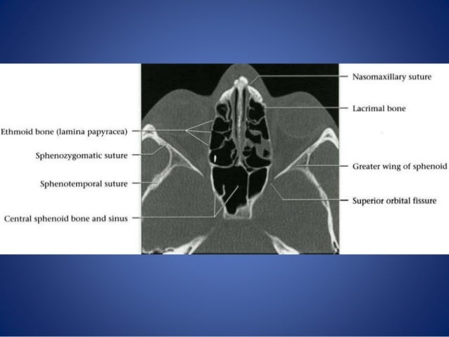 Orbit imaging anatomy