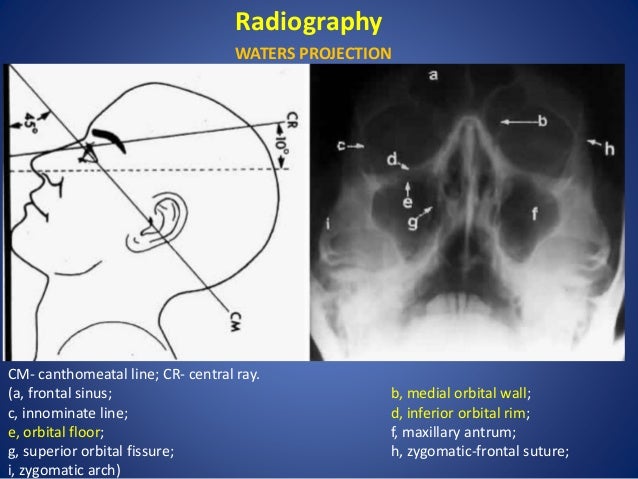 Orbit imaging anatomy