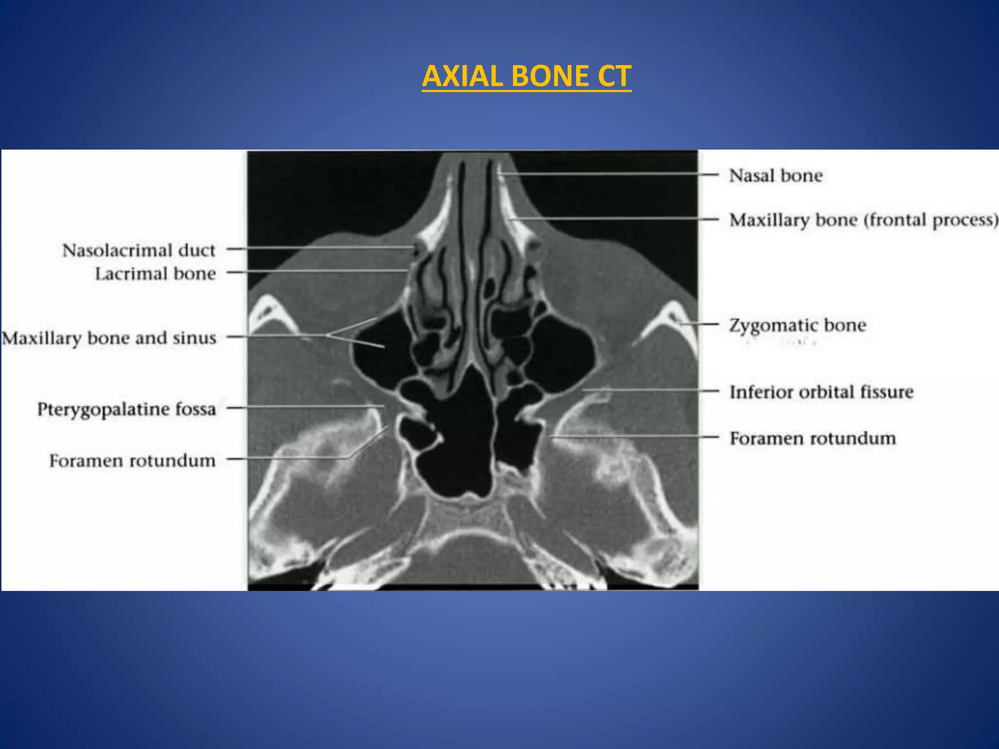 Orbit imaging anatomy | PPTX