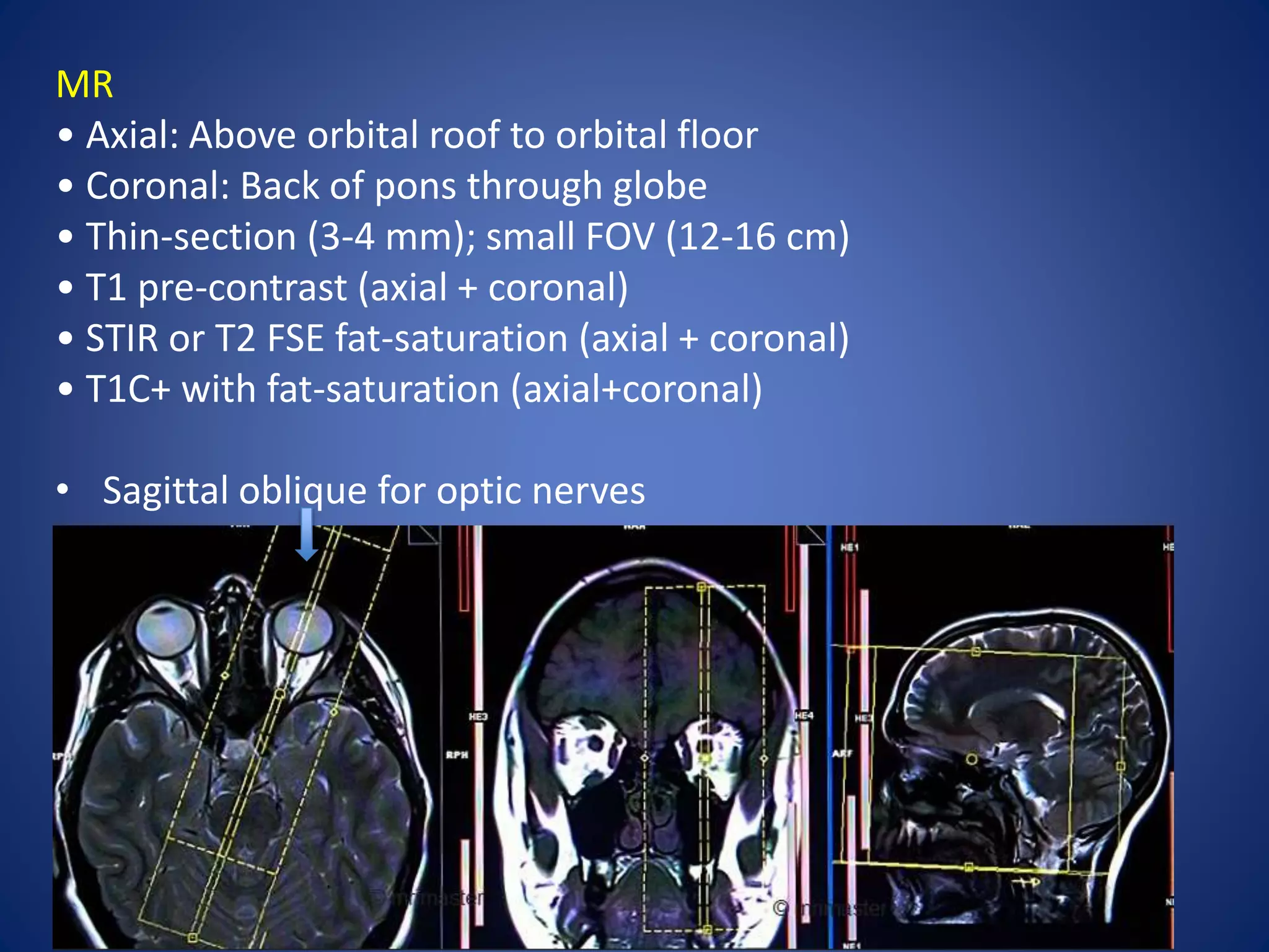 Orbit imaging anatomy | PPTX
