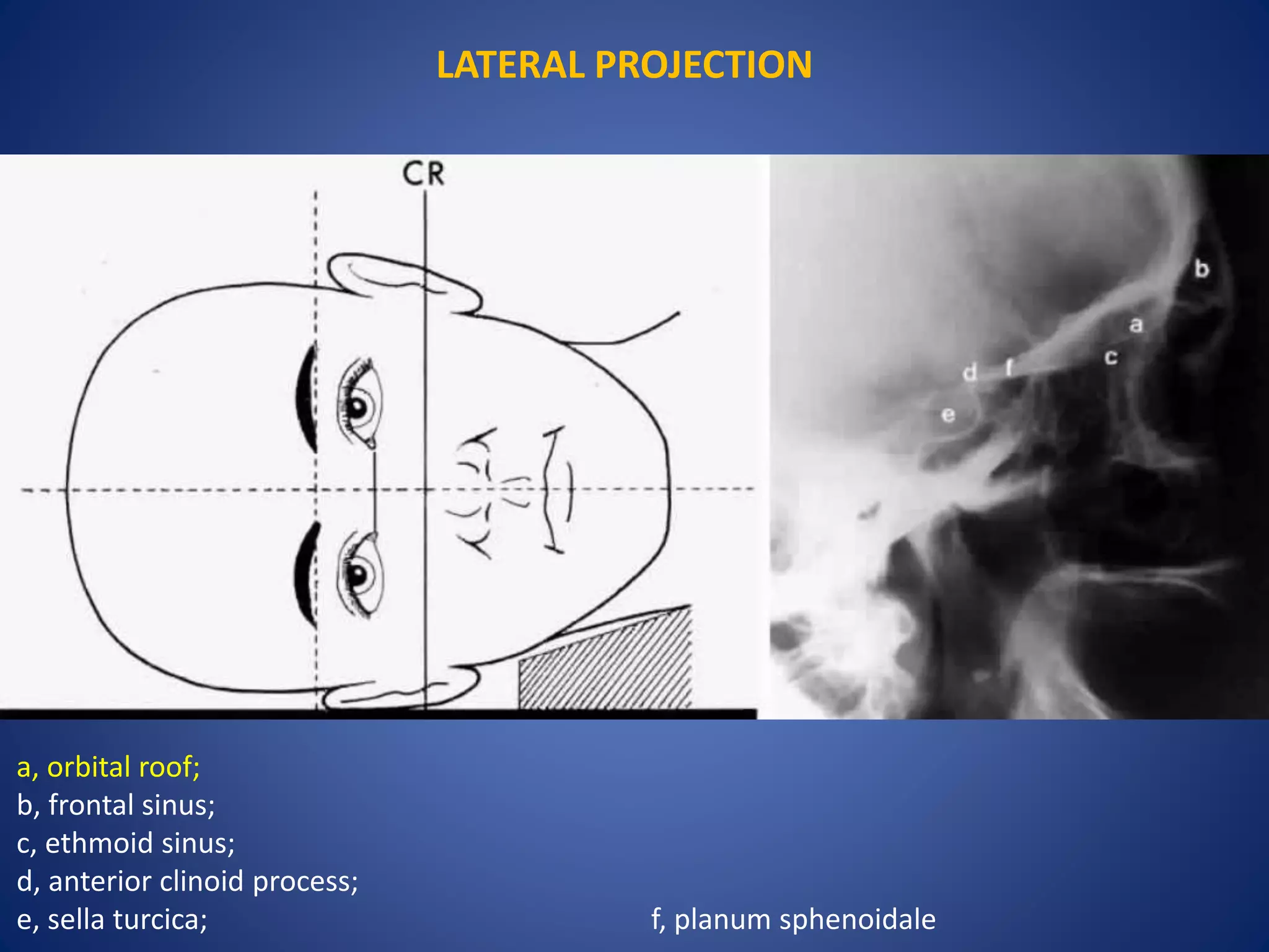 Orbit imaging anatomy | PPTX