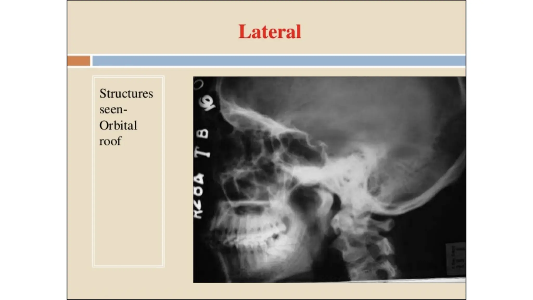 ORBIT part 1 (SSIMS).pptx. Eyes and concept of ophthalmology | PPTX