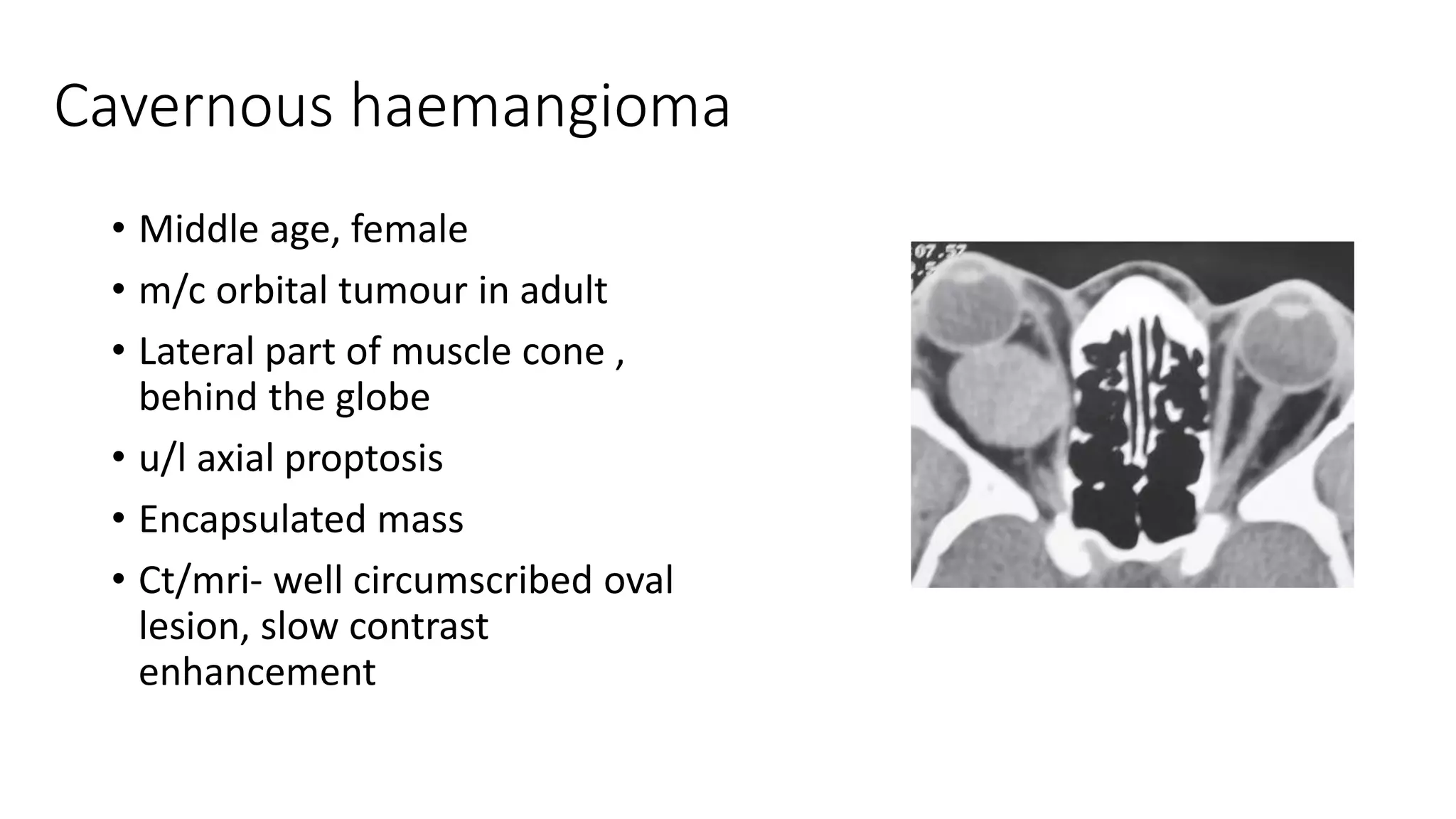 anatomy of orbital spaces, tumours and its importance | PDF
