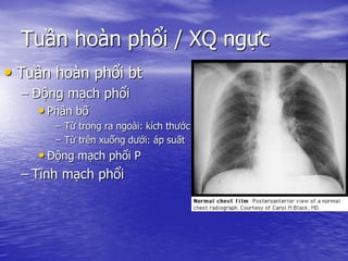 X QUANG NGỰC TRONG BỆNH LÝ TIM MẠCH | PPT