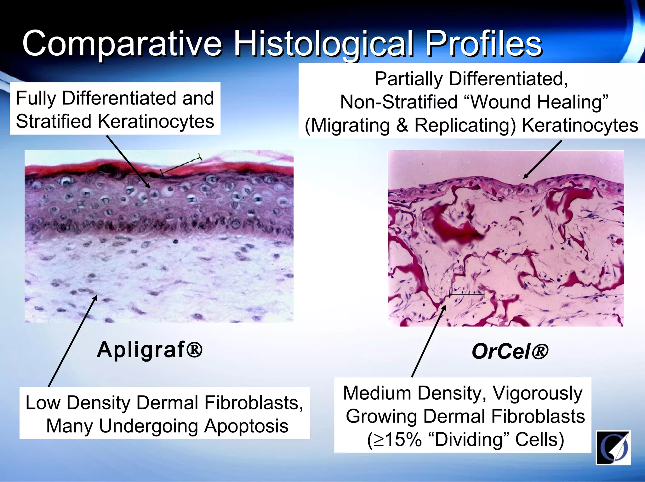 Orcel vs apligraf v4 | PPT