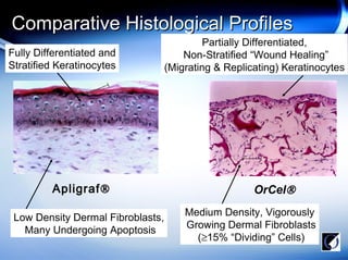 Orcel vs apligraf v4 | PPT