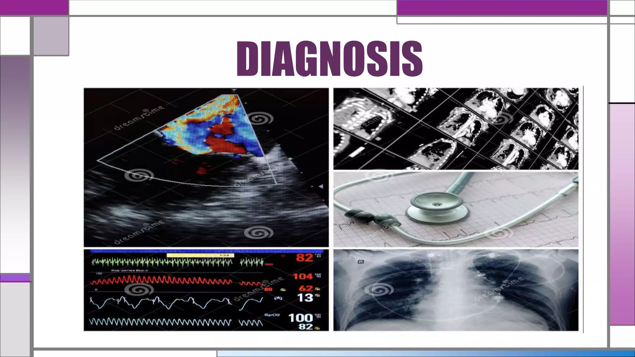 Orchitis & epididymitis | PPTX
