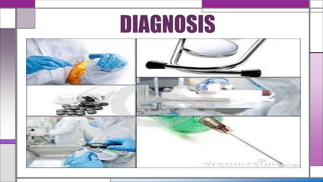 Orchitis & epididymitis | PPTX | Sexual Conditions | Sexual Health