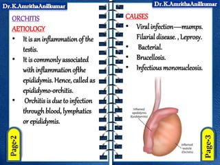 Orchitis by Dr.K.AmrithaAnilkumar | PPTX