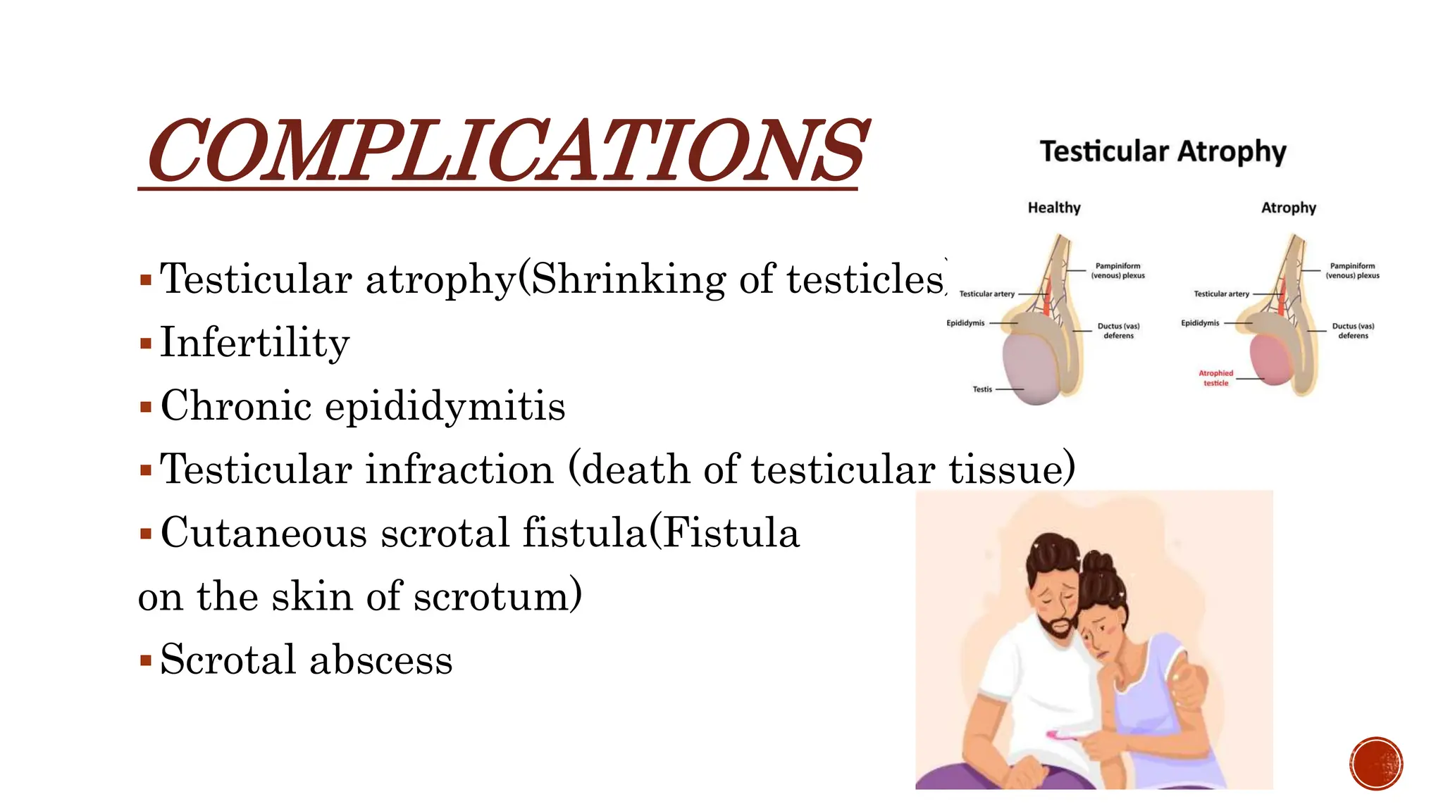 orchitis.pptx | Infertility | Reproductive Health