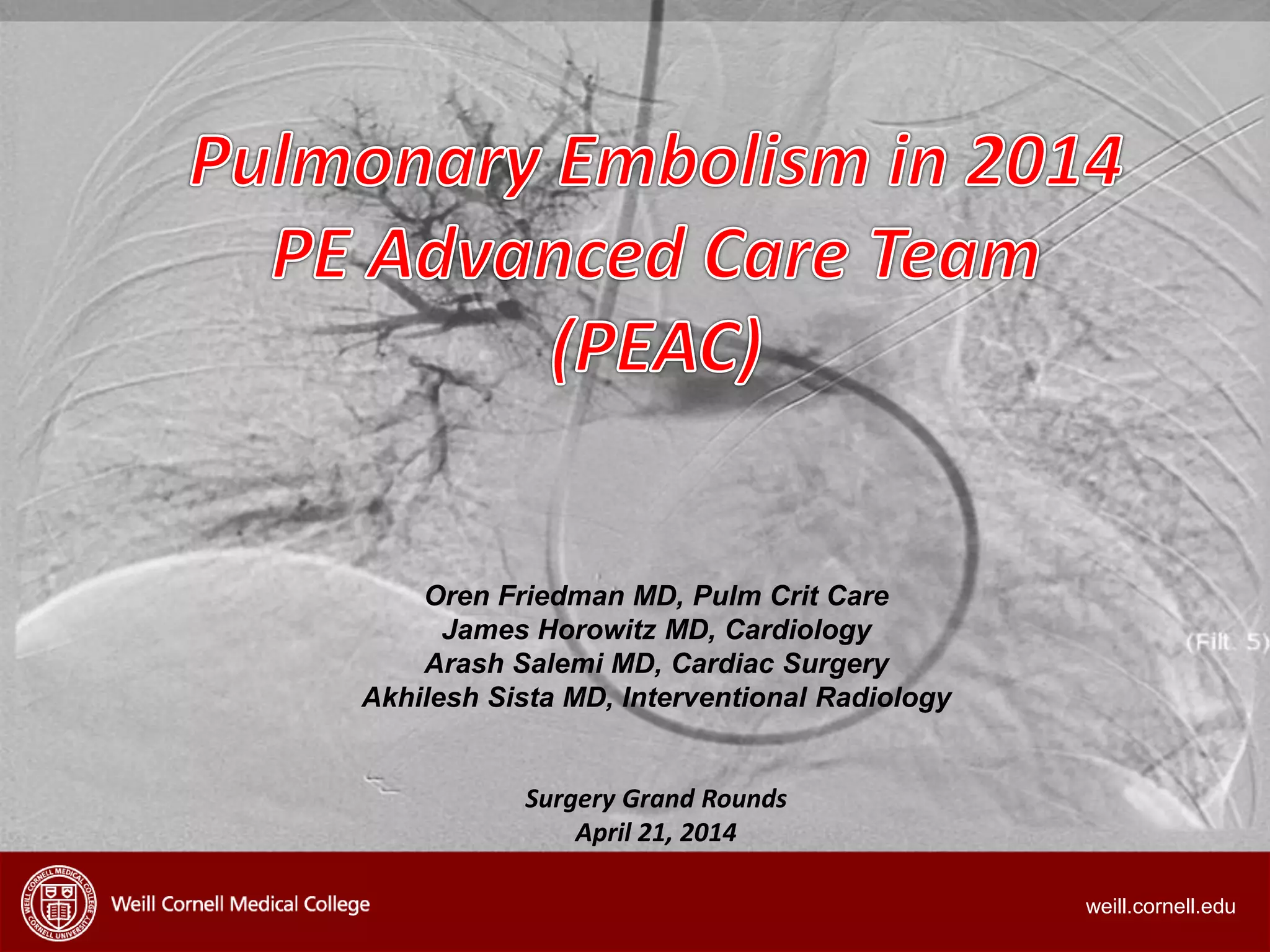 CLOT Team Treatment of Sub-Massive and Massive PE | PPT
