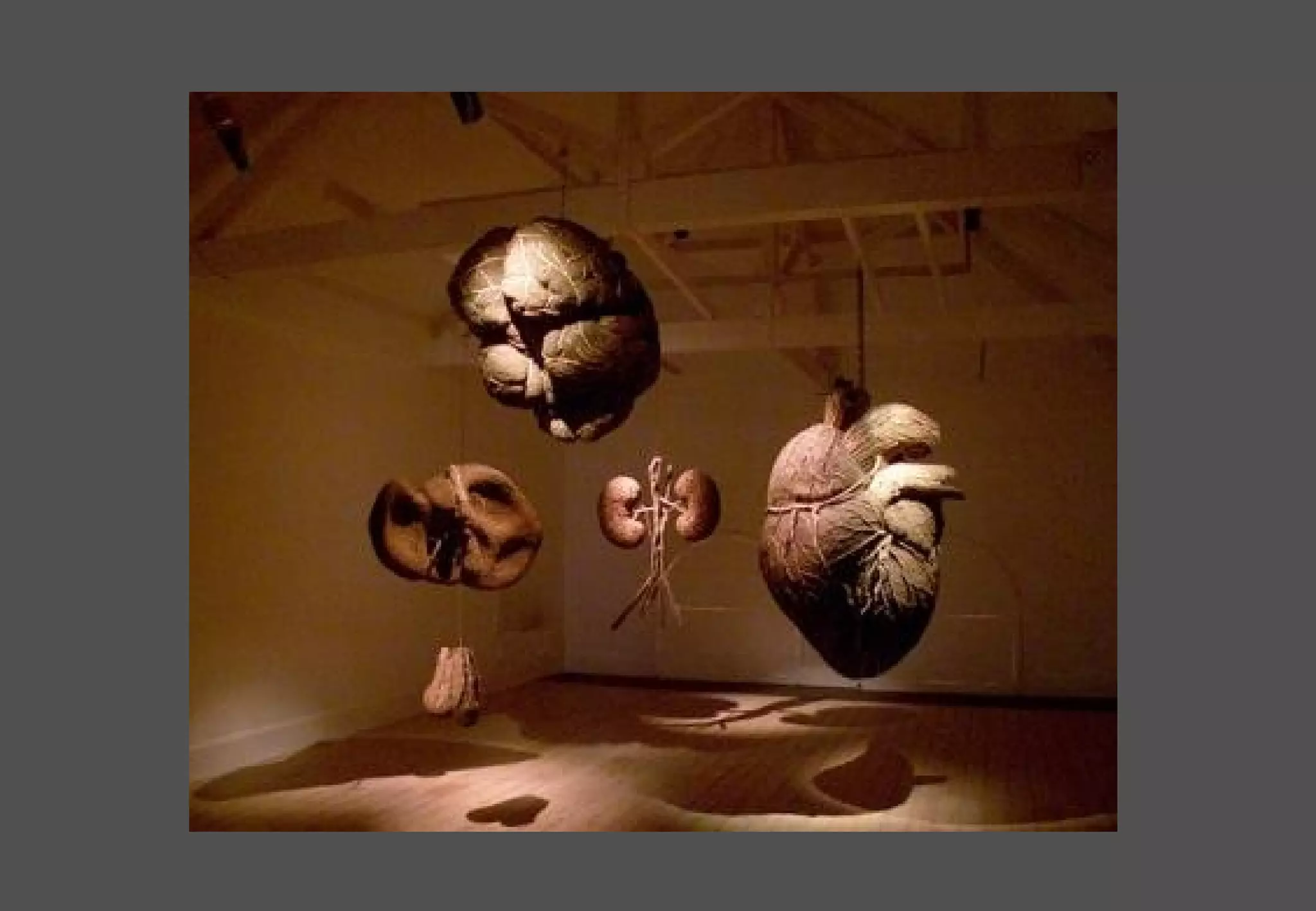 Derma Organ ("Organ Donor") | PPT | Free Download