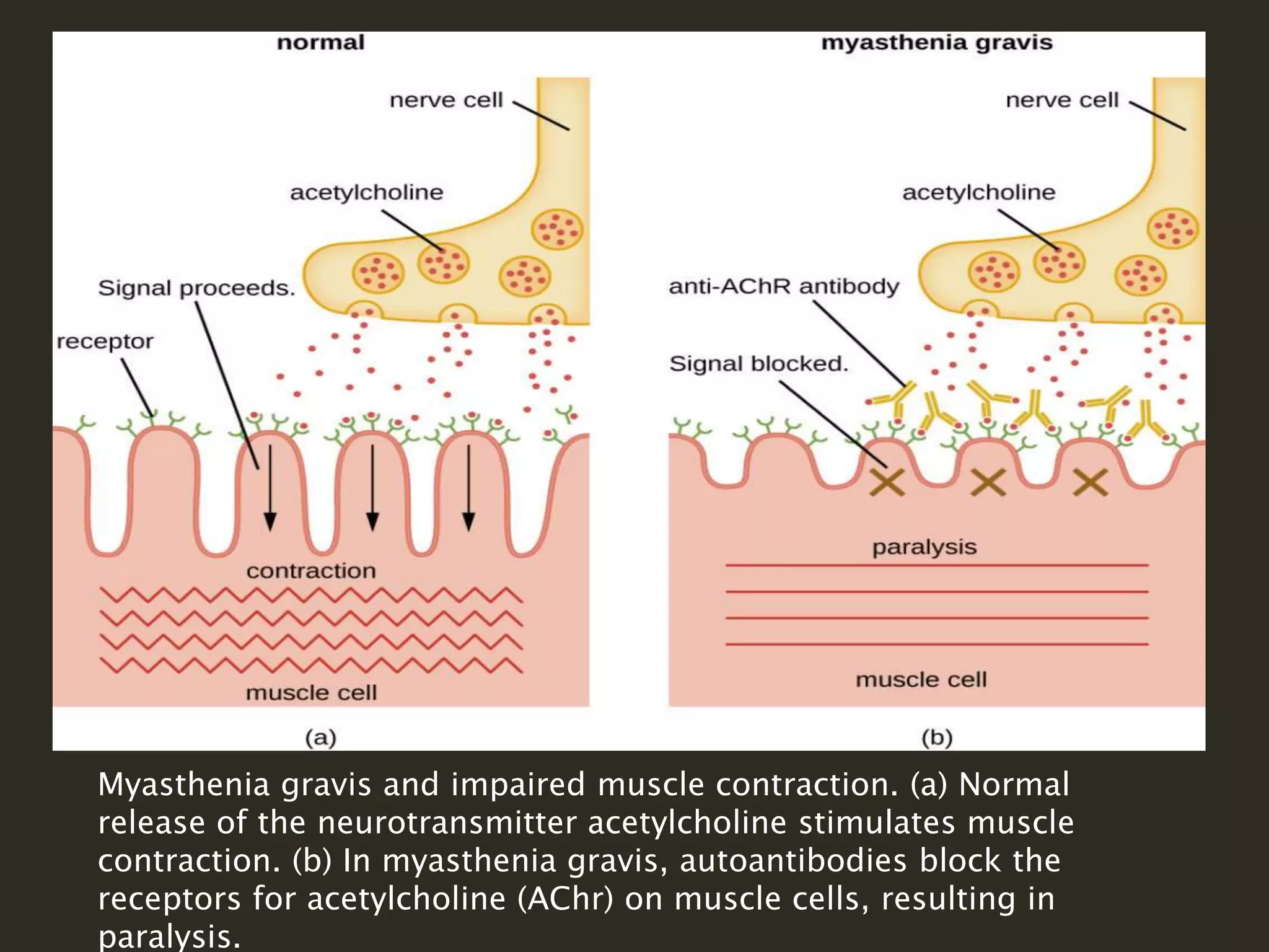 Organ specific autoimmune | PPTX