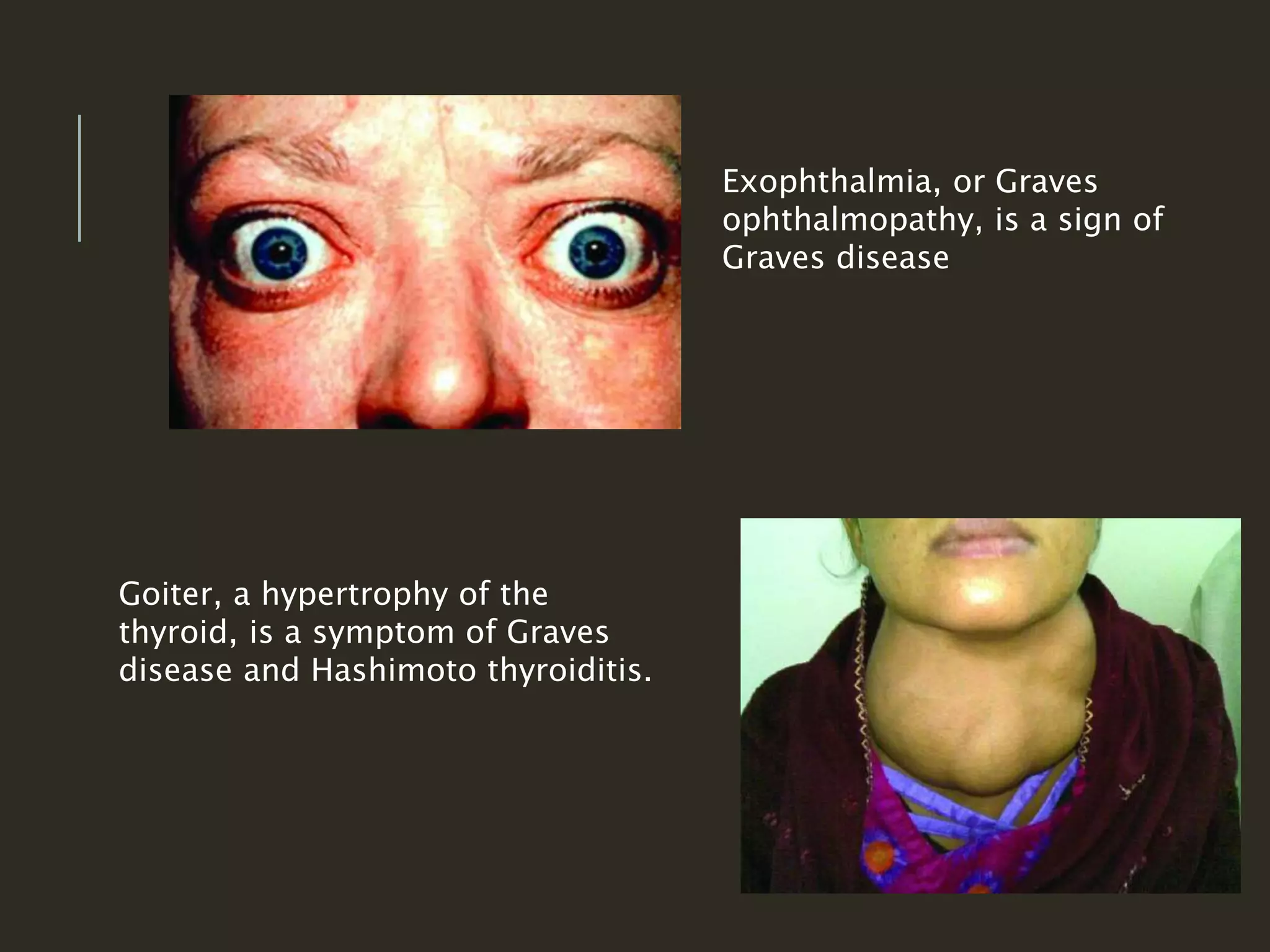 Organ specific autoimmune | PPTX